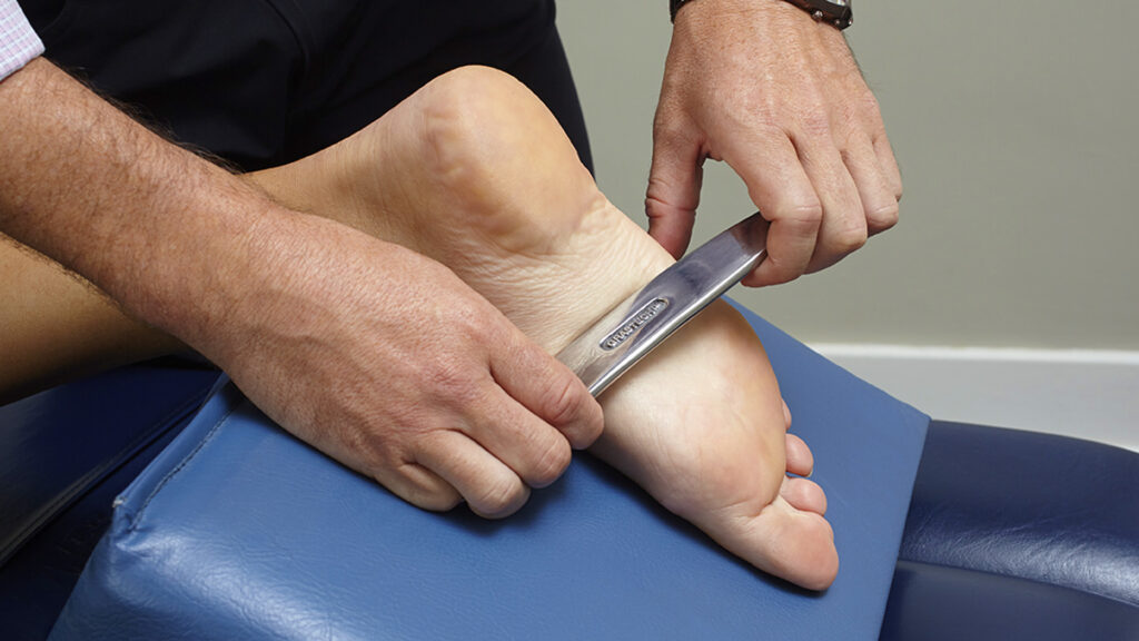 Plantar Fasciitis Pain Relief and Recovery with Graston Technique ...